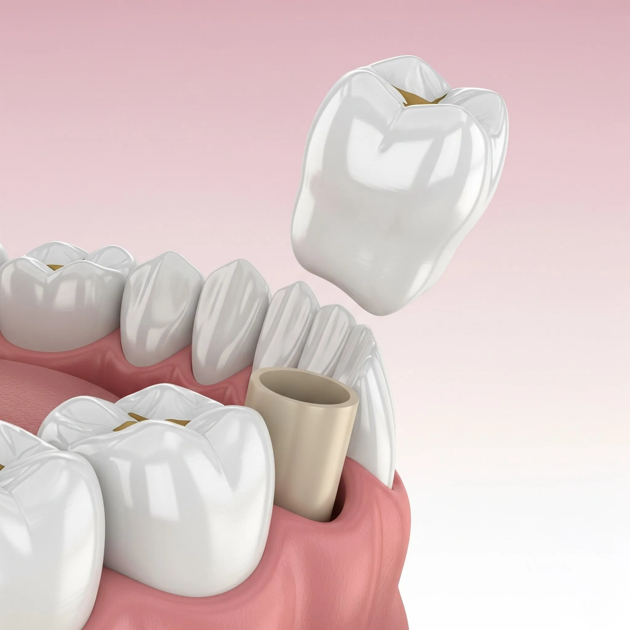 Dentist in New Britain | Family & Cosmetic Dental Care